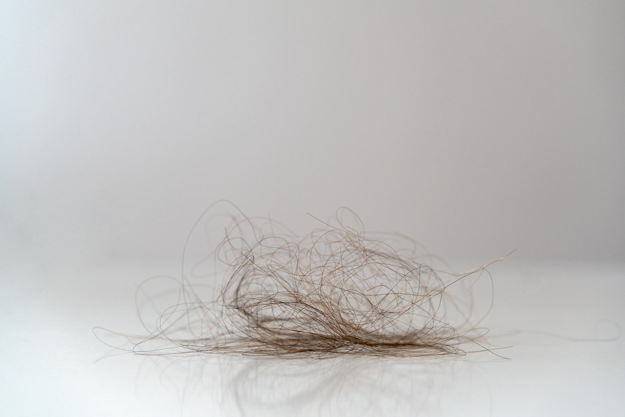 The Hair Restoration Process Explained | Darling Hair Restoration